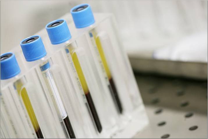 UTB PROJECT - ¿Qué es el PRGF®-Endoret®? ¿Cómo se prepara?